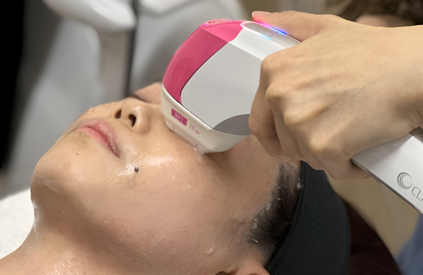 How Long Does HIFU Last: 4 Factors Affecting Result Duration