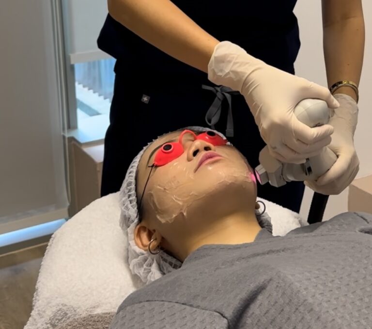 Acne Clear Laser Program - Lux Medical Aesthetic Clinic