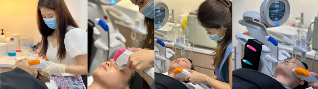 Ultraformer MPT: The Latest Advancement in HIFU Lifting