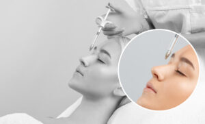 Fillers: What They Are, 5 Types, Benefits, and Treatment Areas