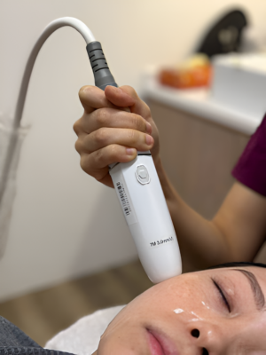 Atrophic Scars: What It Is, Causes, and Treatment