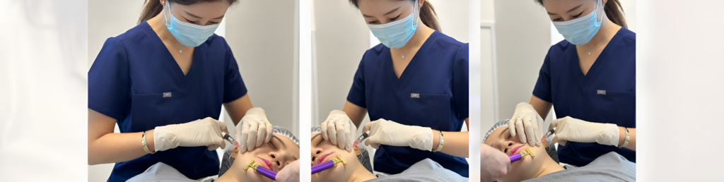 Profhilo Treatment in Singapore: HA Injectable Moisturiser