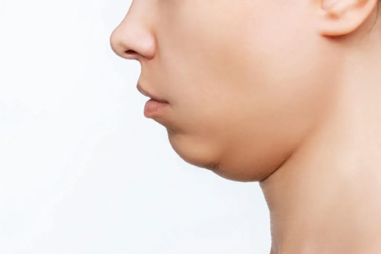 Receding Chin: Causes, 4 Treatments, and Prevention