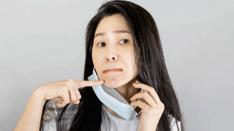 Pustules: What are they, Causes, Treatment Options, & Prevention Tips